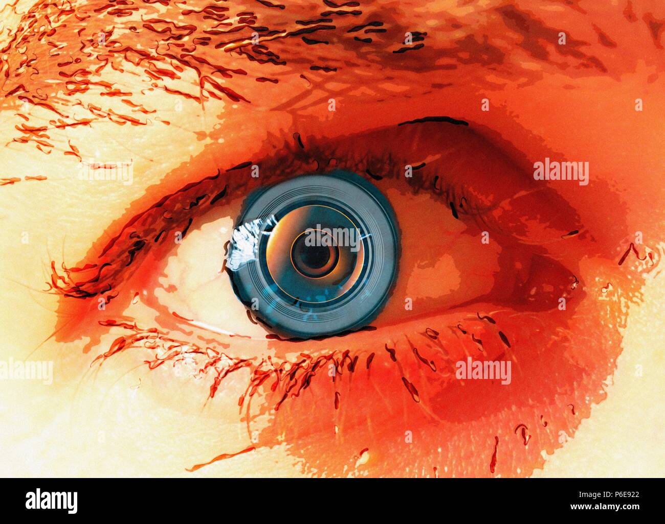 Cybernetic Eye Implants