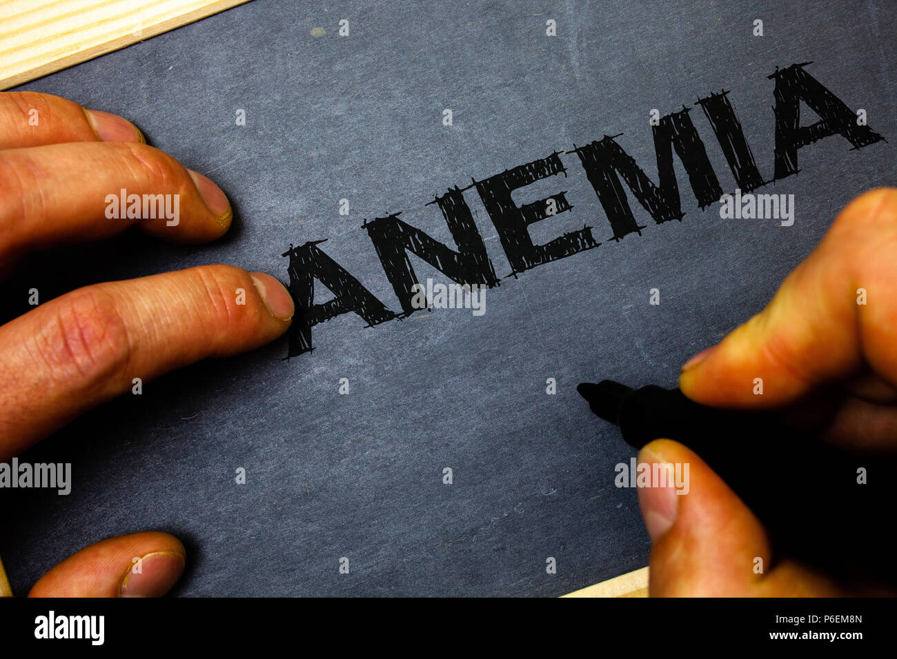 Word writing text Anemia. Business concept for Bloodlessness Disease ...
