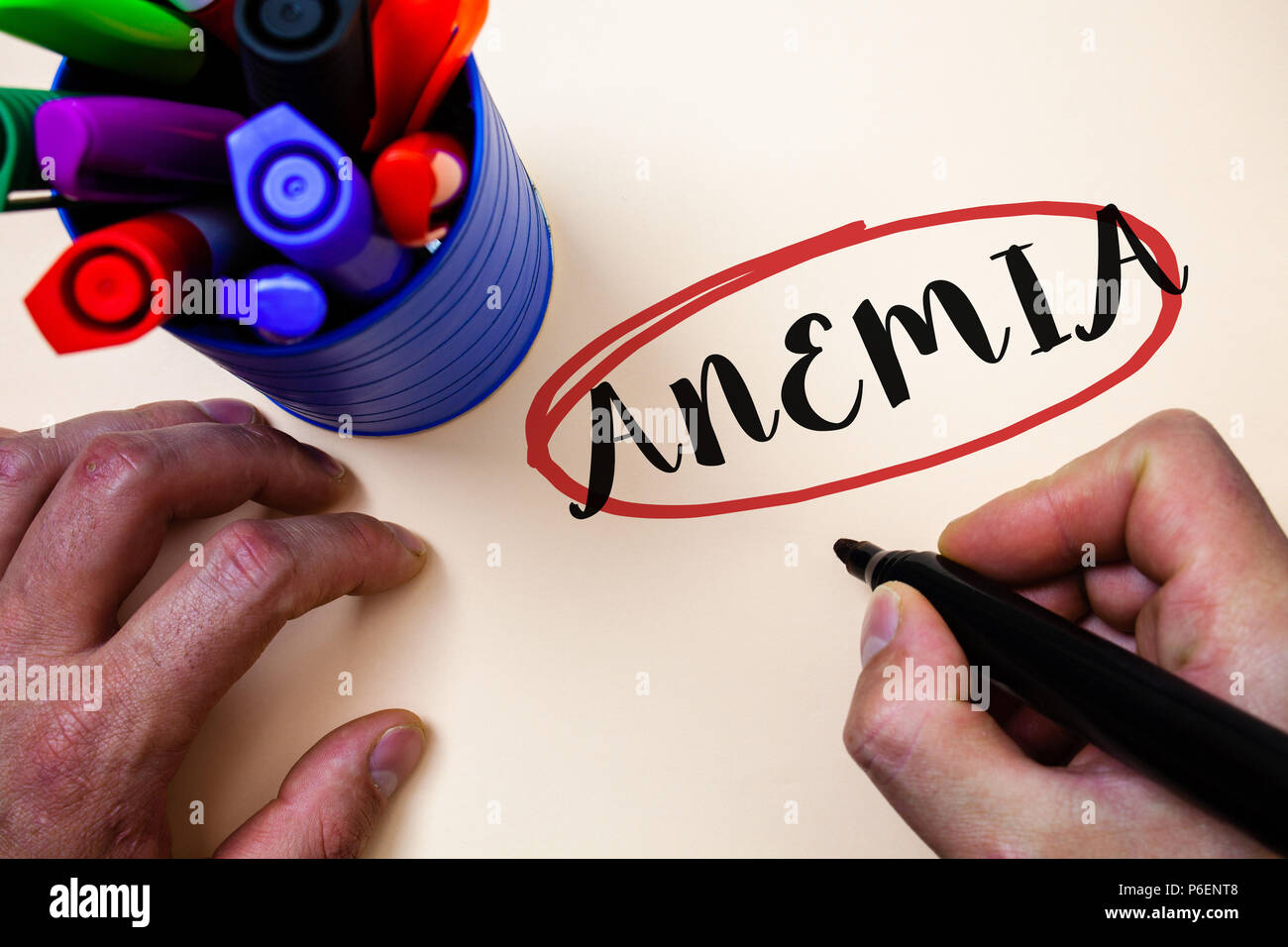 Conceptual hand writing showing Anemia. Business photo text ...