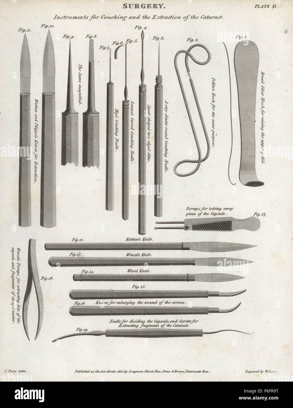 Cataract surgery couching hi-res stock photography and images - Alamy