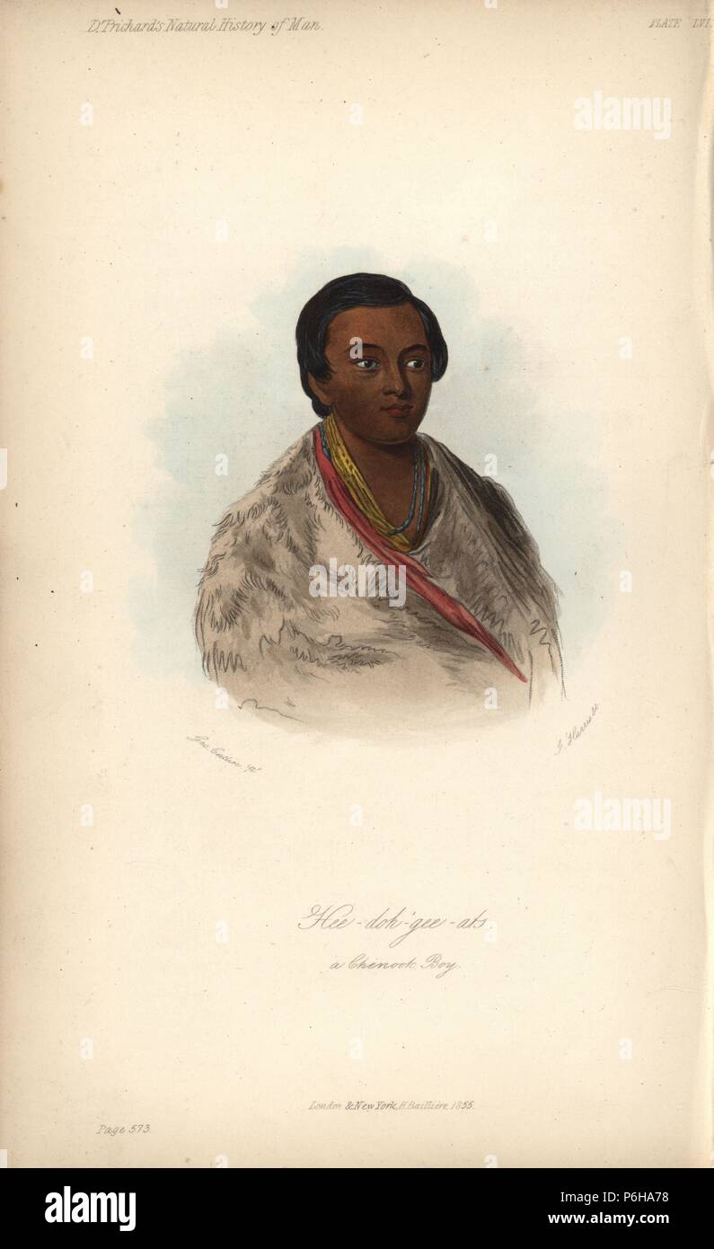 Hee-doh-gee-ats, a Chinook boy of 15 or 18 years of age whose head had ...