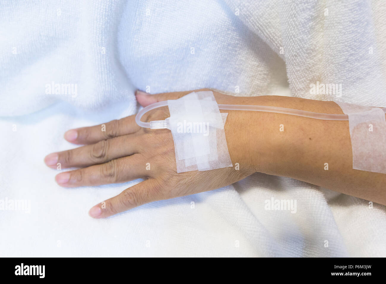 Focus on the hands of female patients take saline intravenous in the ...