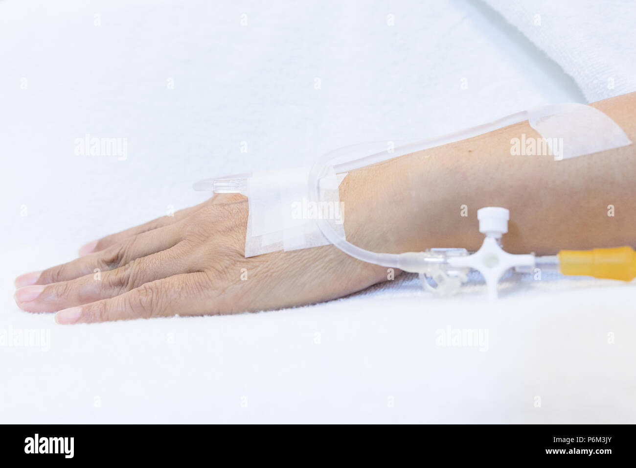 Focus on the hands of female patients take saline intravenous in the ...