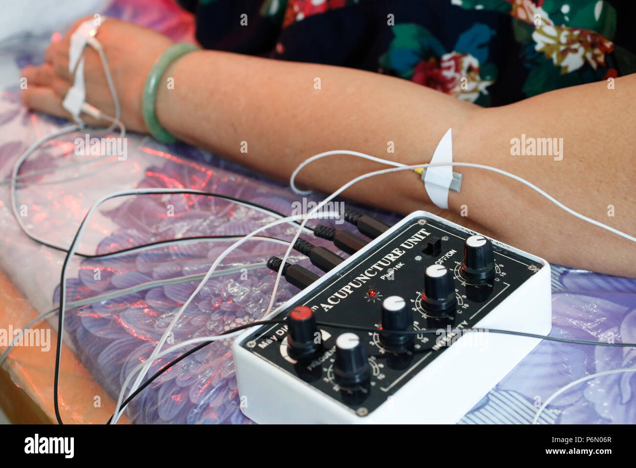 Vietnamese traditional medicine clinic. Acupuncture. Cu Chi. Vietnam ...