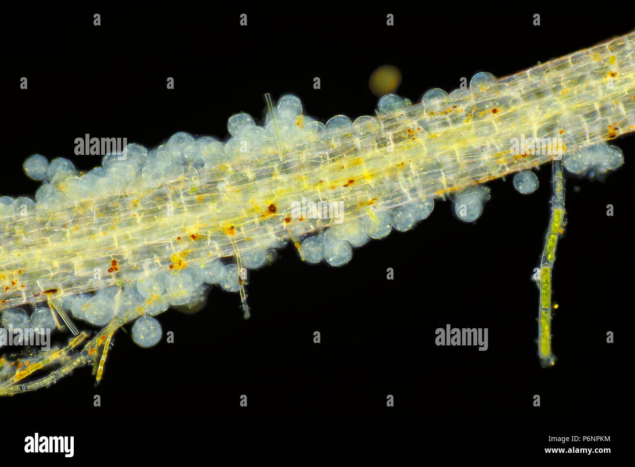 Microscopy Microphotography Stock Photos & Microscopy Microphotography ...