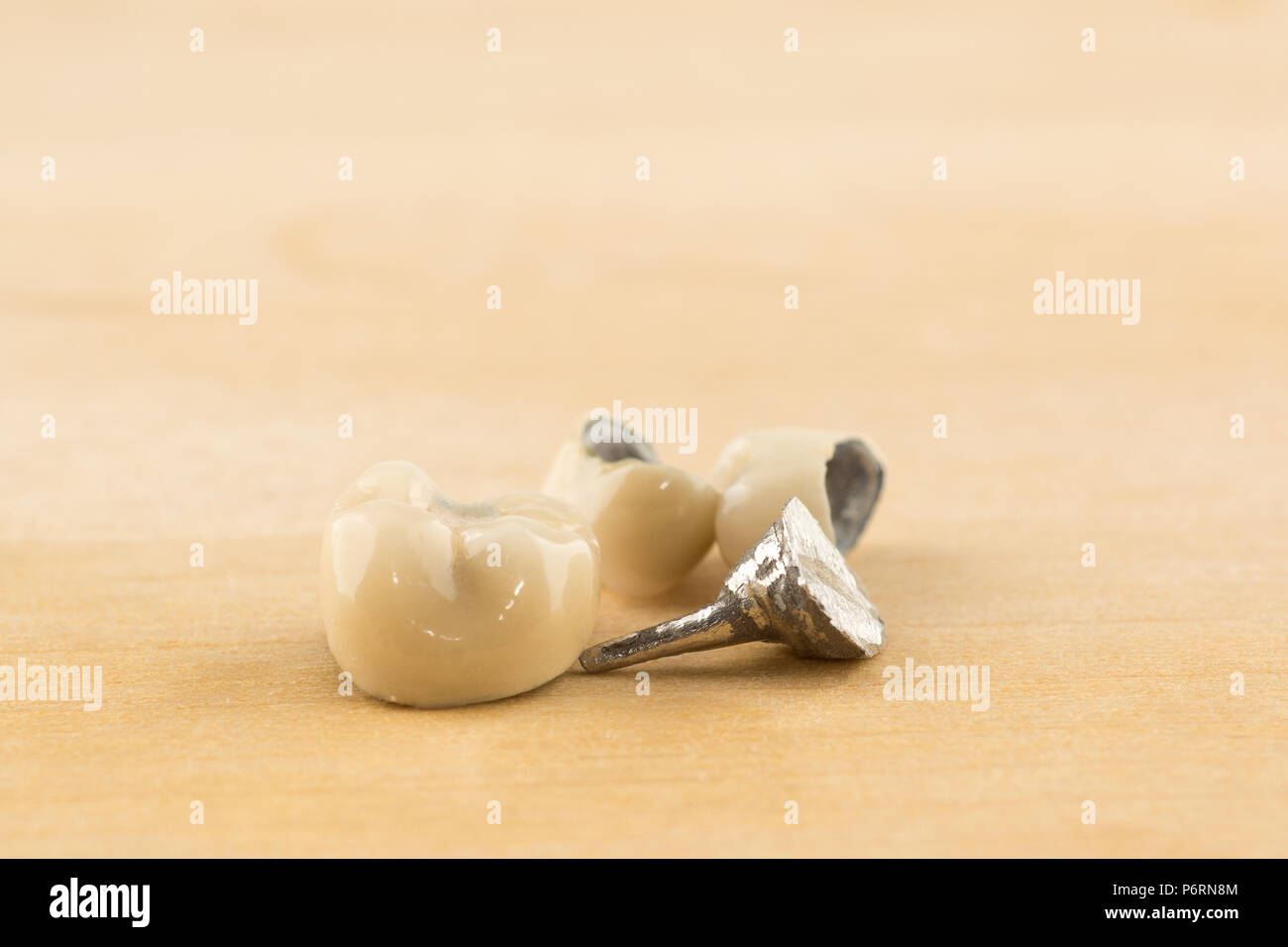 Dental metal free ceramic crown hi-res stock photography and images - Alamy