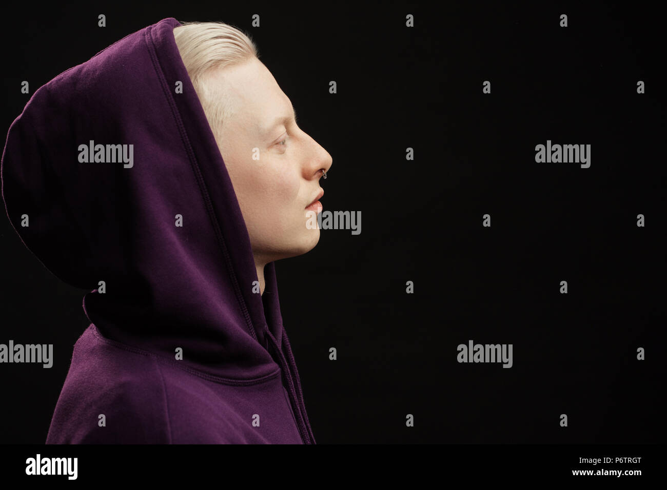 Albino model hi-res stock photography and images - Alamy