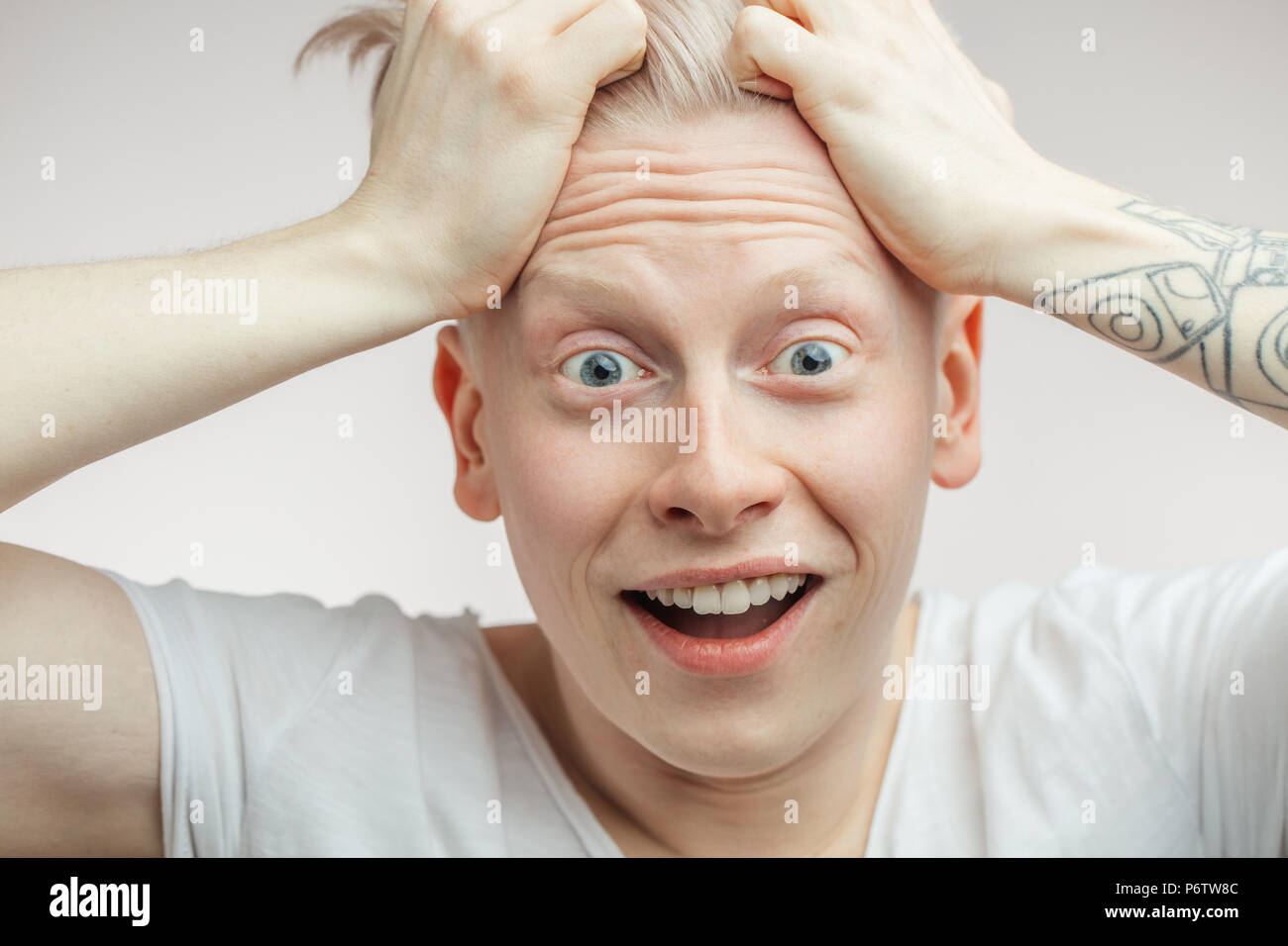 Albino face close up hi-res stock photography and images - Alamy