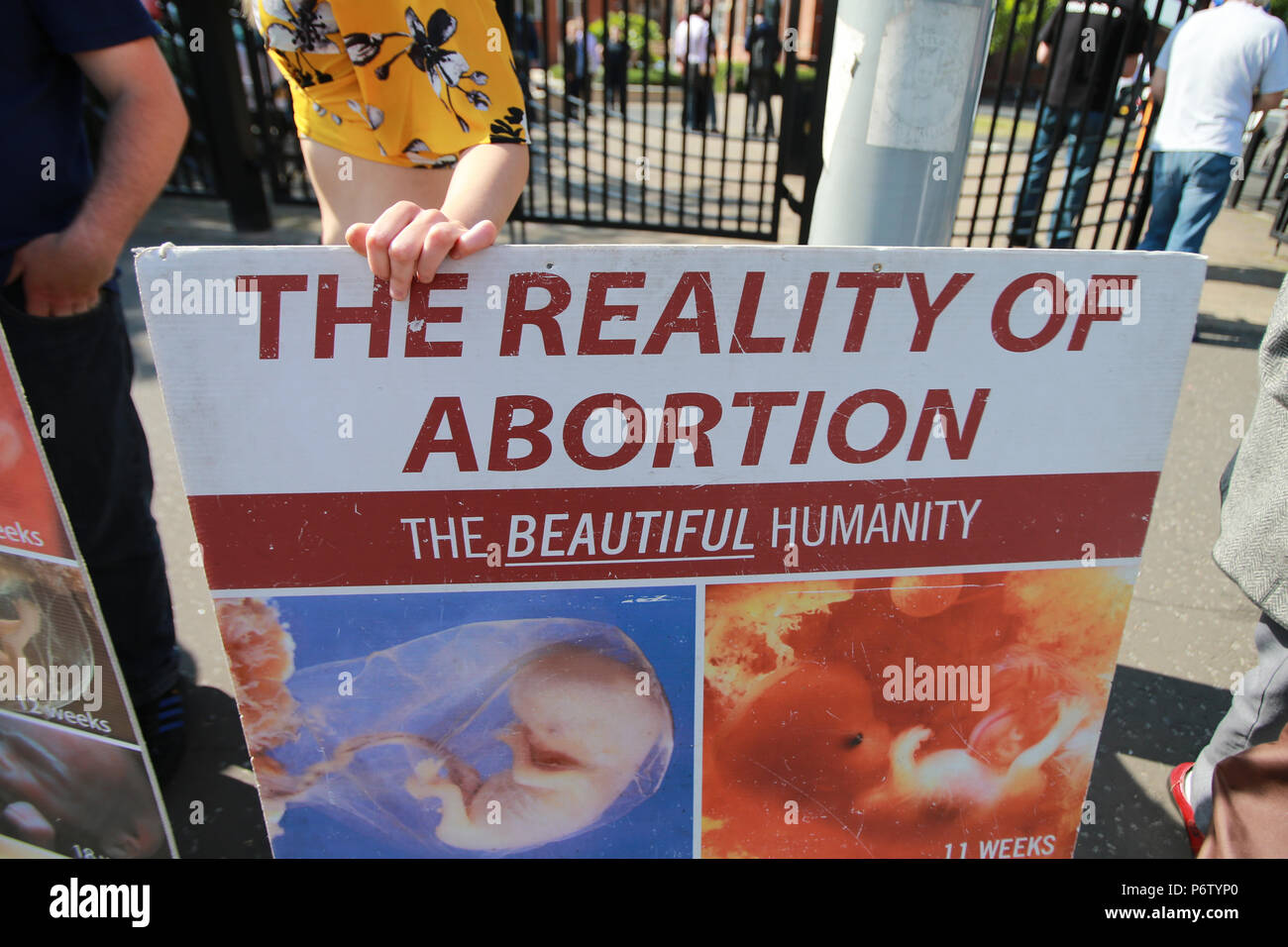 Abortion is the ending of pregnancy due to removing an embryo or fetus ...