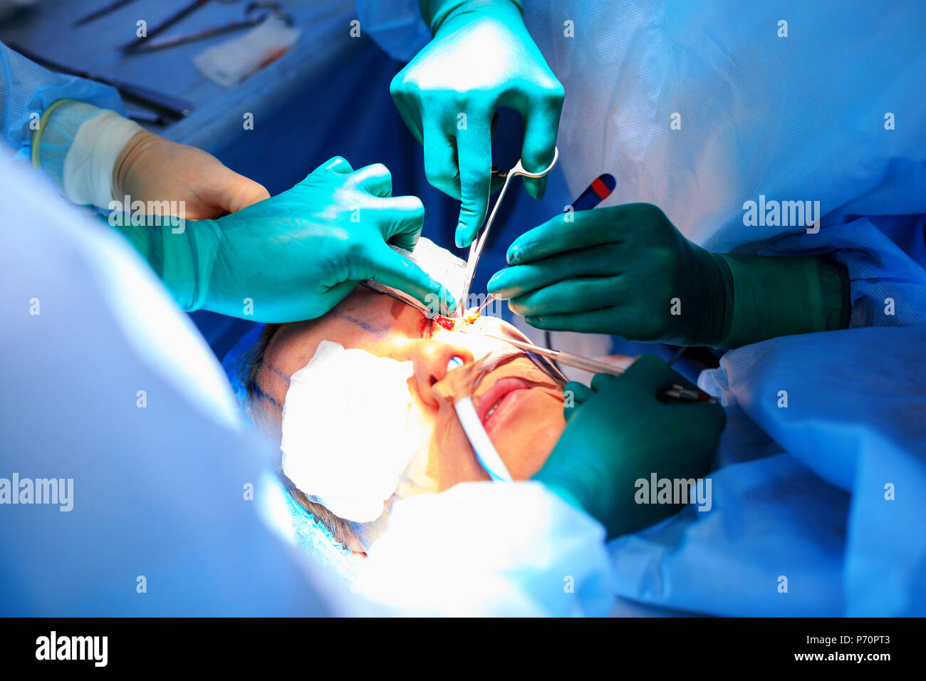 Plastic surgery in operating room Stock Photo - Alamy