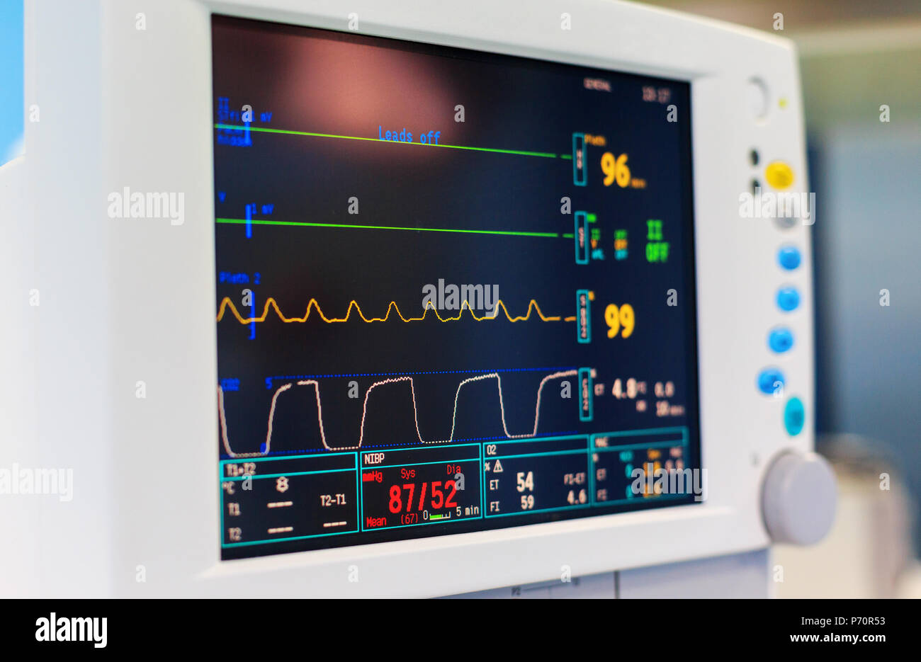 Hospital er vital signs hi-res stock photography and images - Alamy