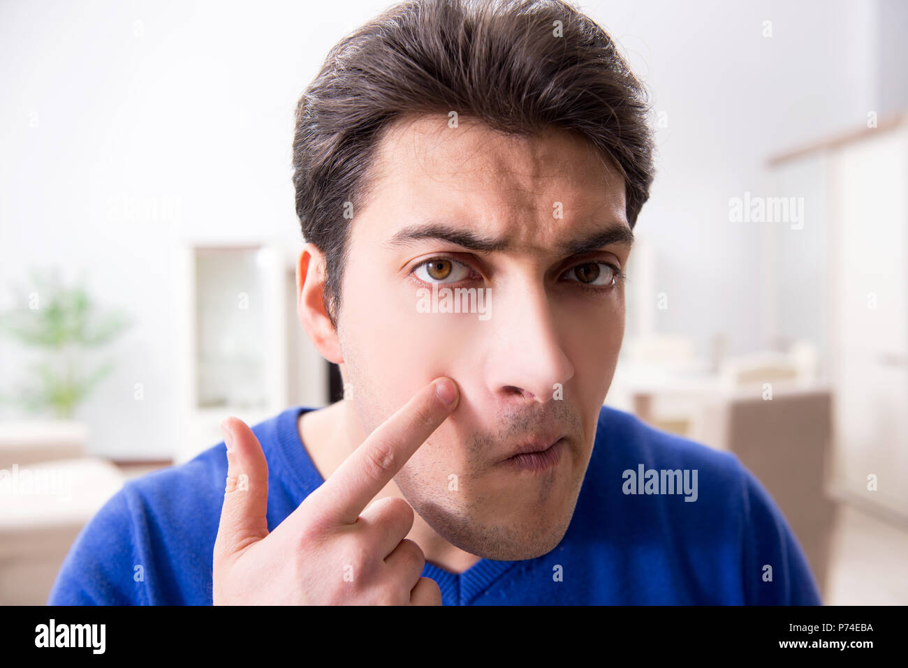 Man panicking because of pimples on the skin Stock Photo - Alamy