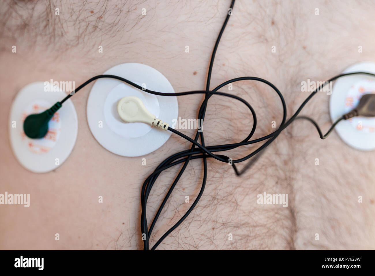 Holter monitor hi-res stock photography and images - Alamy
