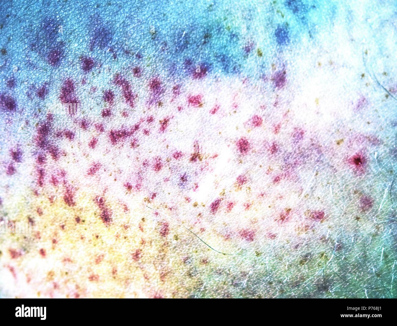 Trauma haemorrhage blood hi-res stock photography and images - Alamy
