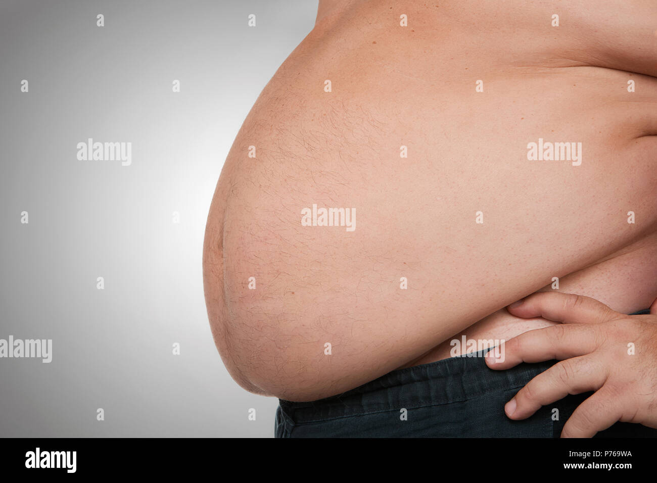 Fat man stomach beer belly hi-res stock photography and images - Alamy