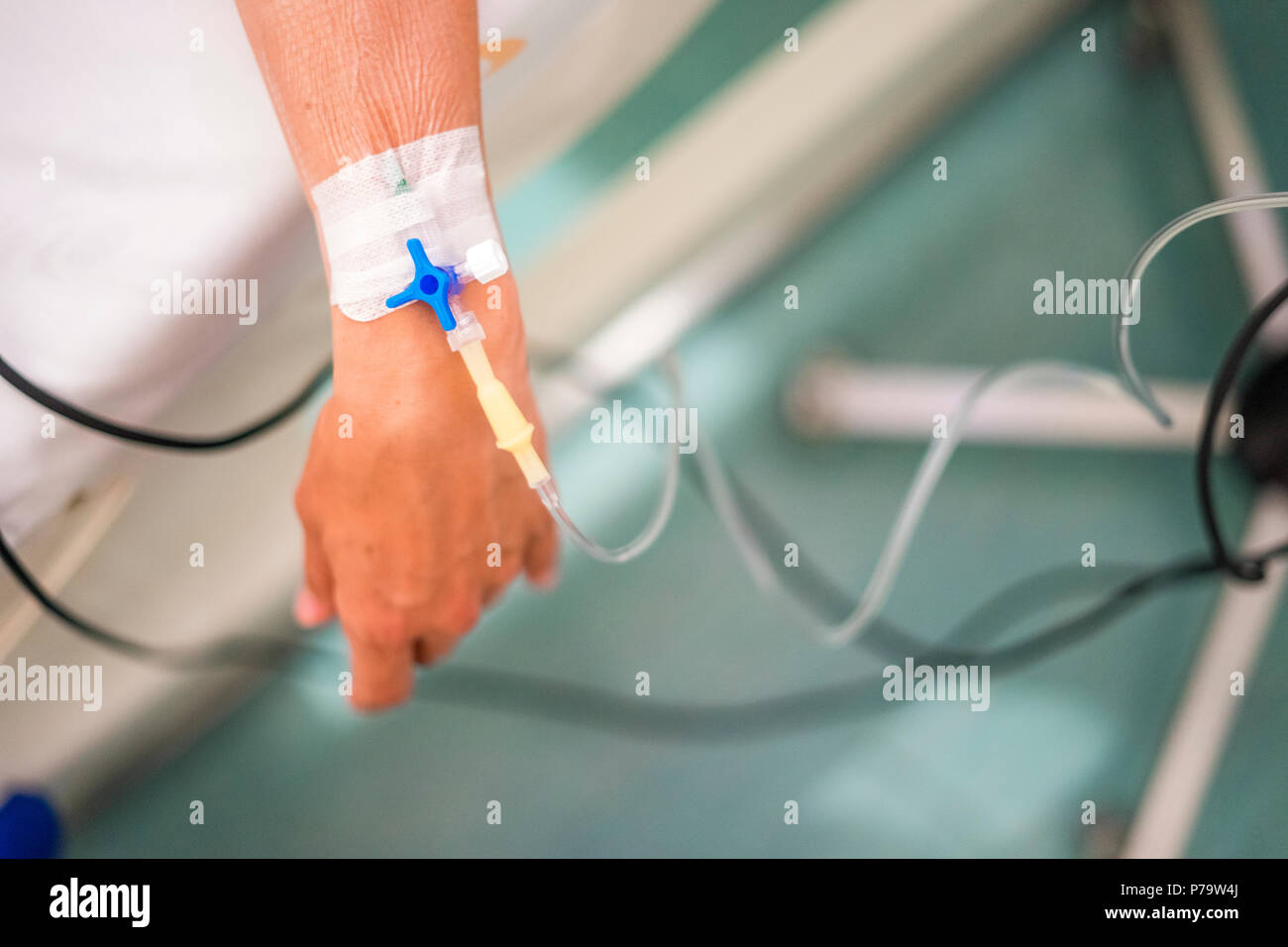 Peripheral venous catheter hi-res stock photography and images - Alamy