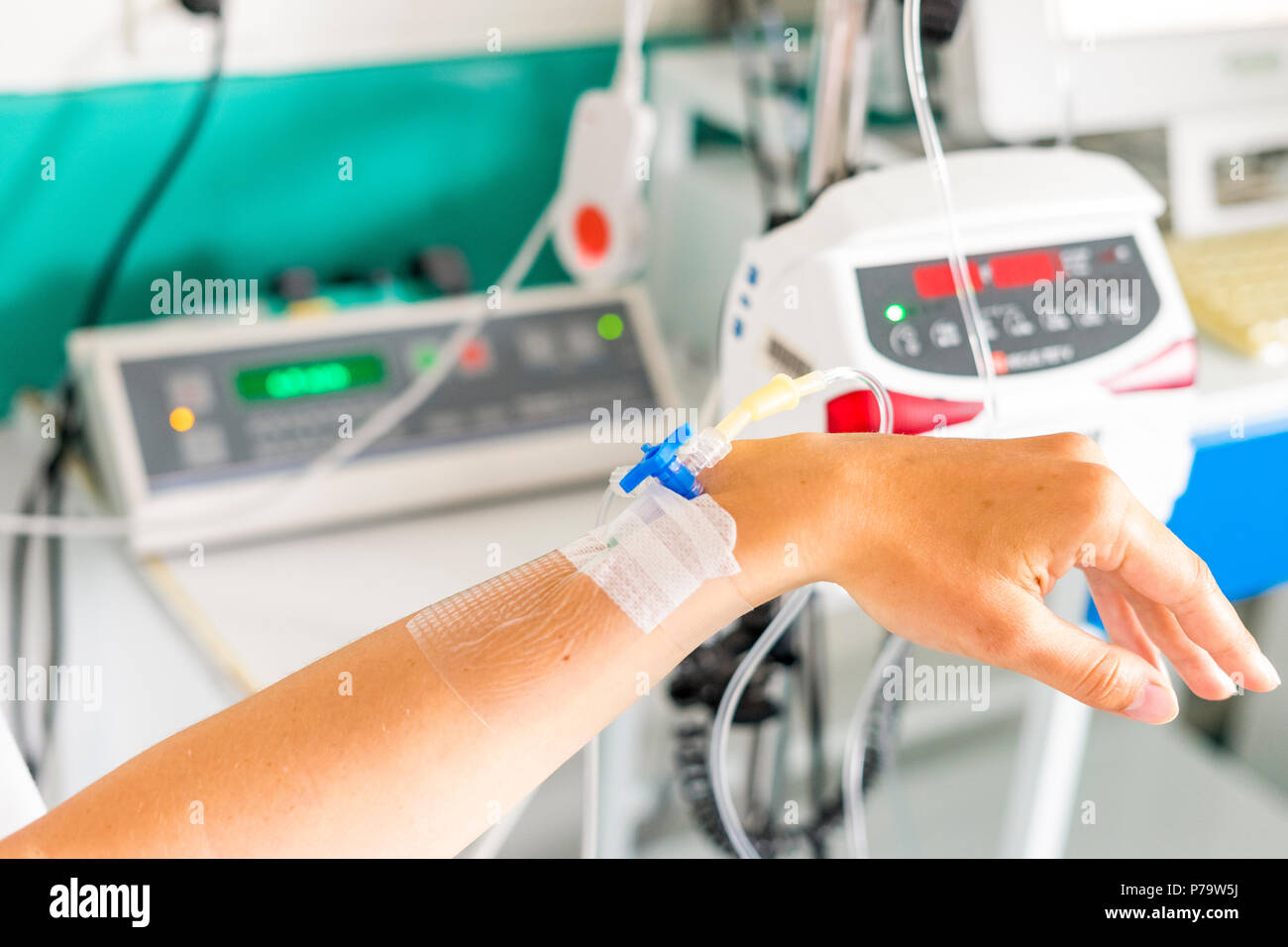 Hand with peripheral venous catheter and equipment to dose epidural ...