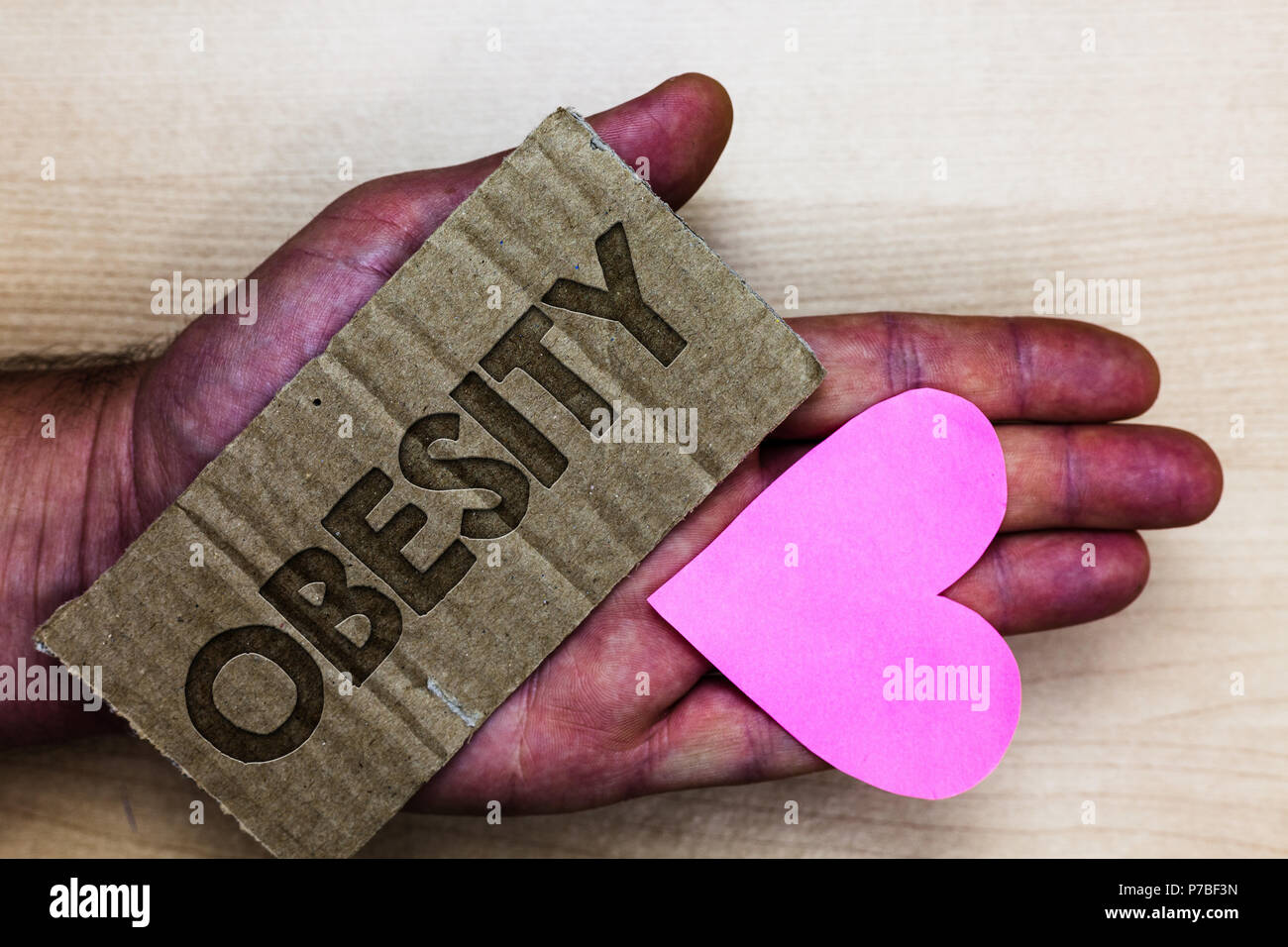 Conceptual hand writing showing Obesity. Business photo text Medical ...