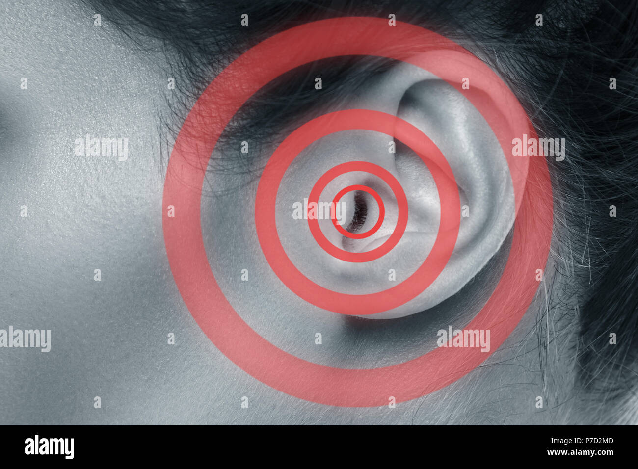 Eardrum otitis hi-res stock photography and images - Alamy