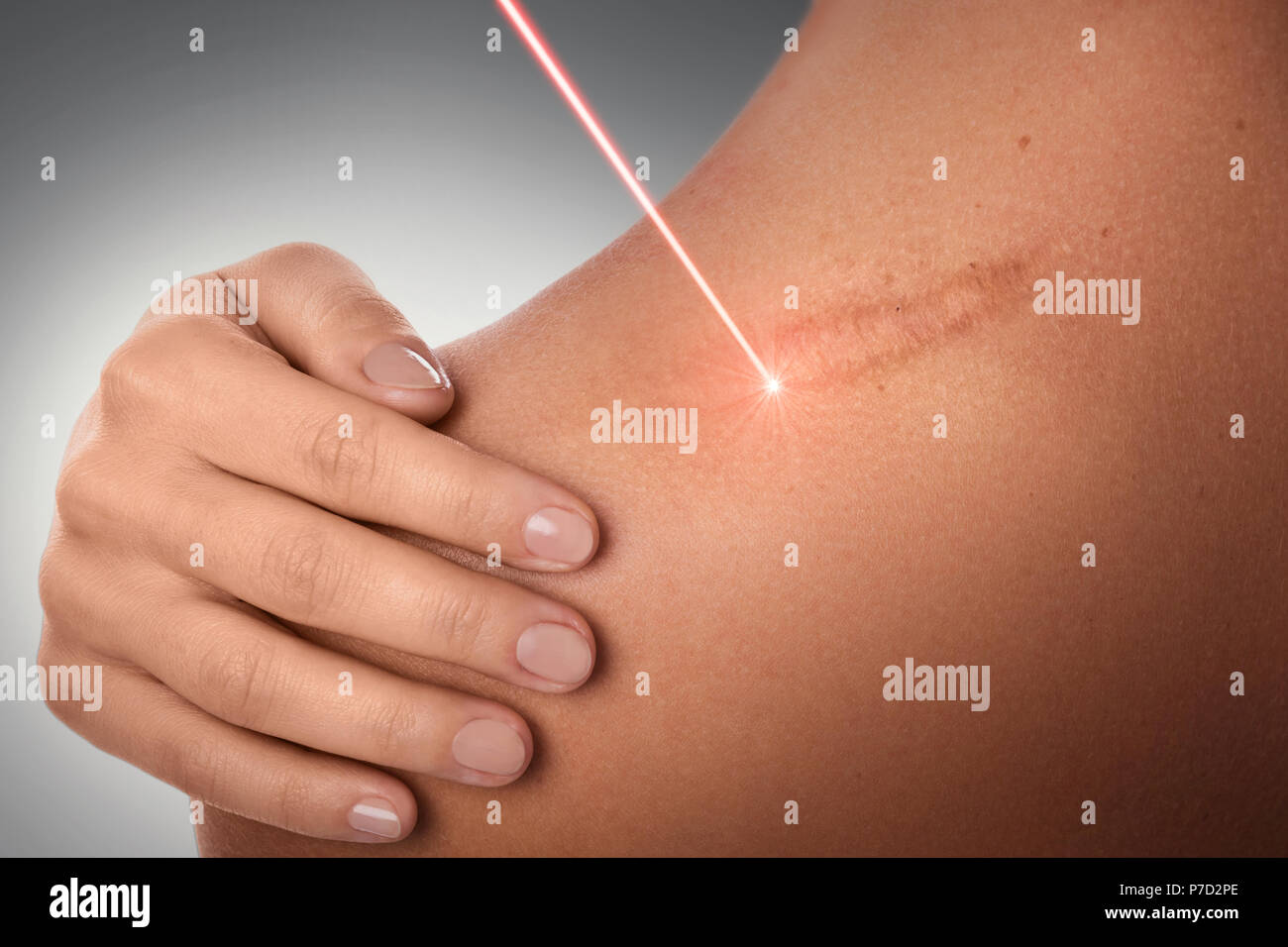Body care concept laser hi-res stock photography and images - Alamy