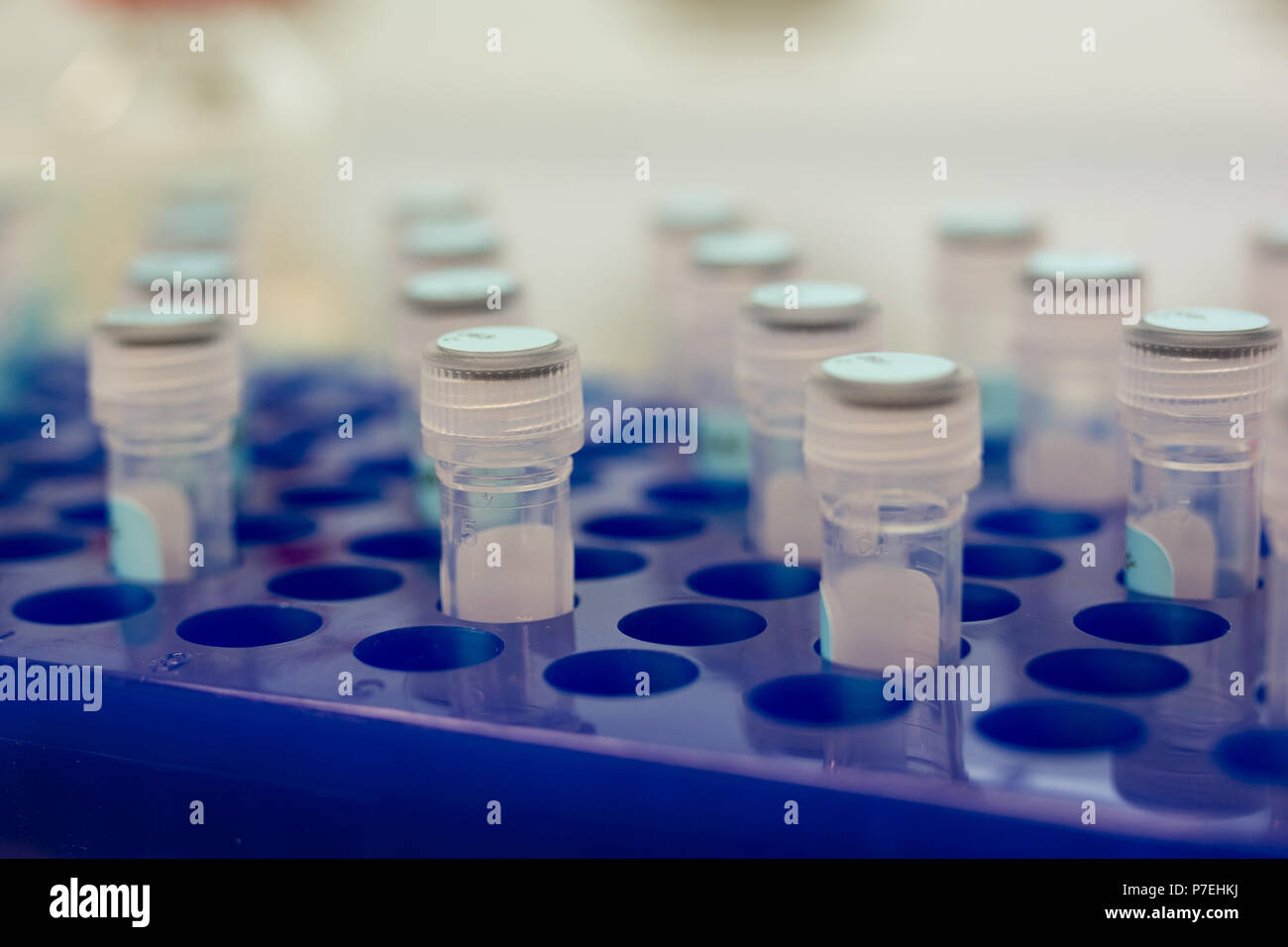 Test tubes in a blue tray with blue labels Stock Photo - Alamy