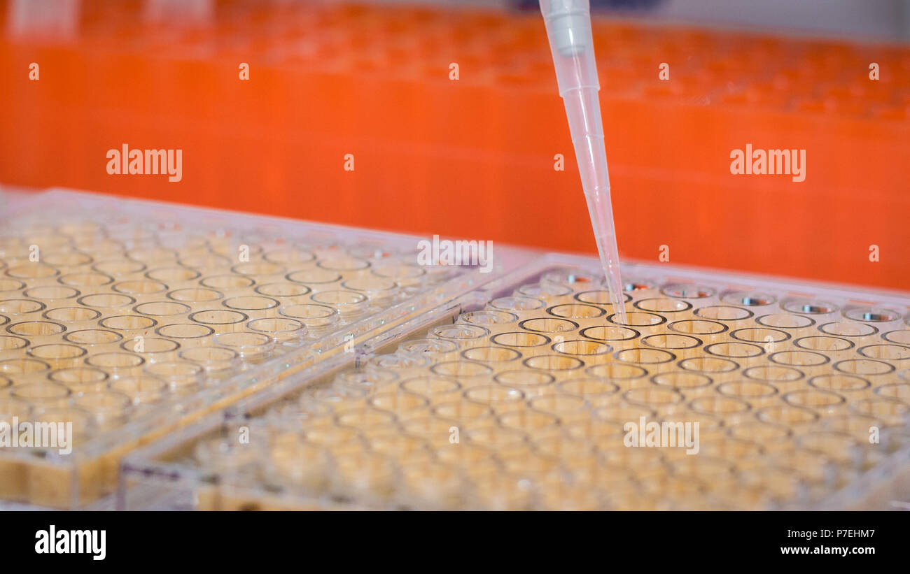Elisa assay hi-res stock photography and images - Alamy