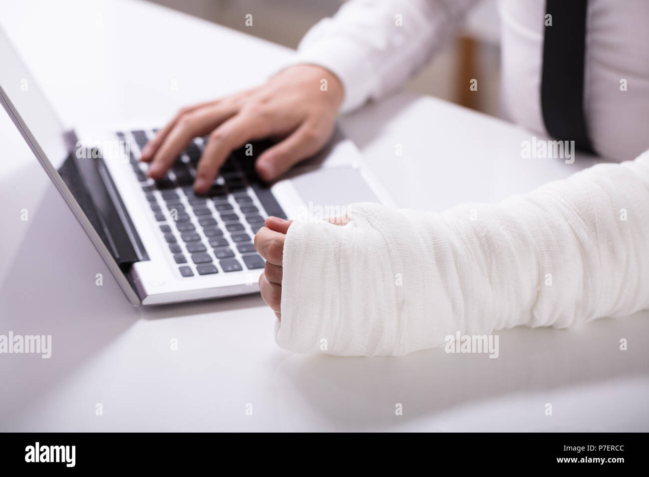 Close-up Of A Man With Fractured Hand Using Laptop Over Desk Stock ...