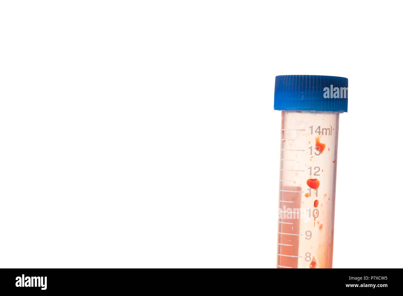 Test tube with blood sample isolated on white background Stock Photo ...