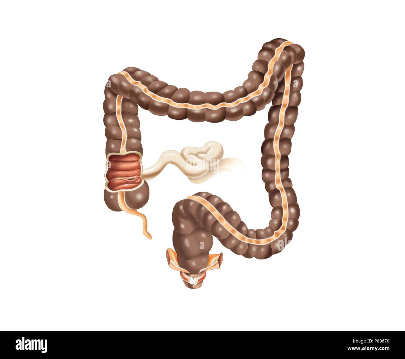 Ileum hi-res stock photography and images - Alamy