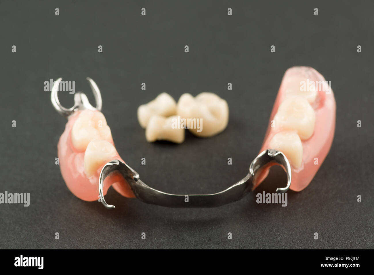 large image of a modern denture on a black background Stock Photo - Alamy