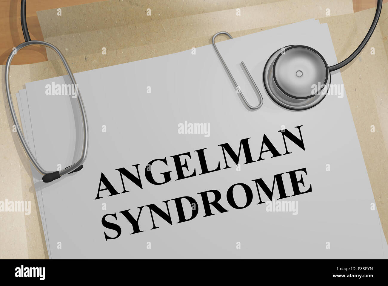 Angelman syndrome disease hi-res stock photography and images - Alamy