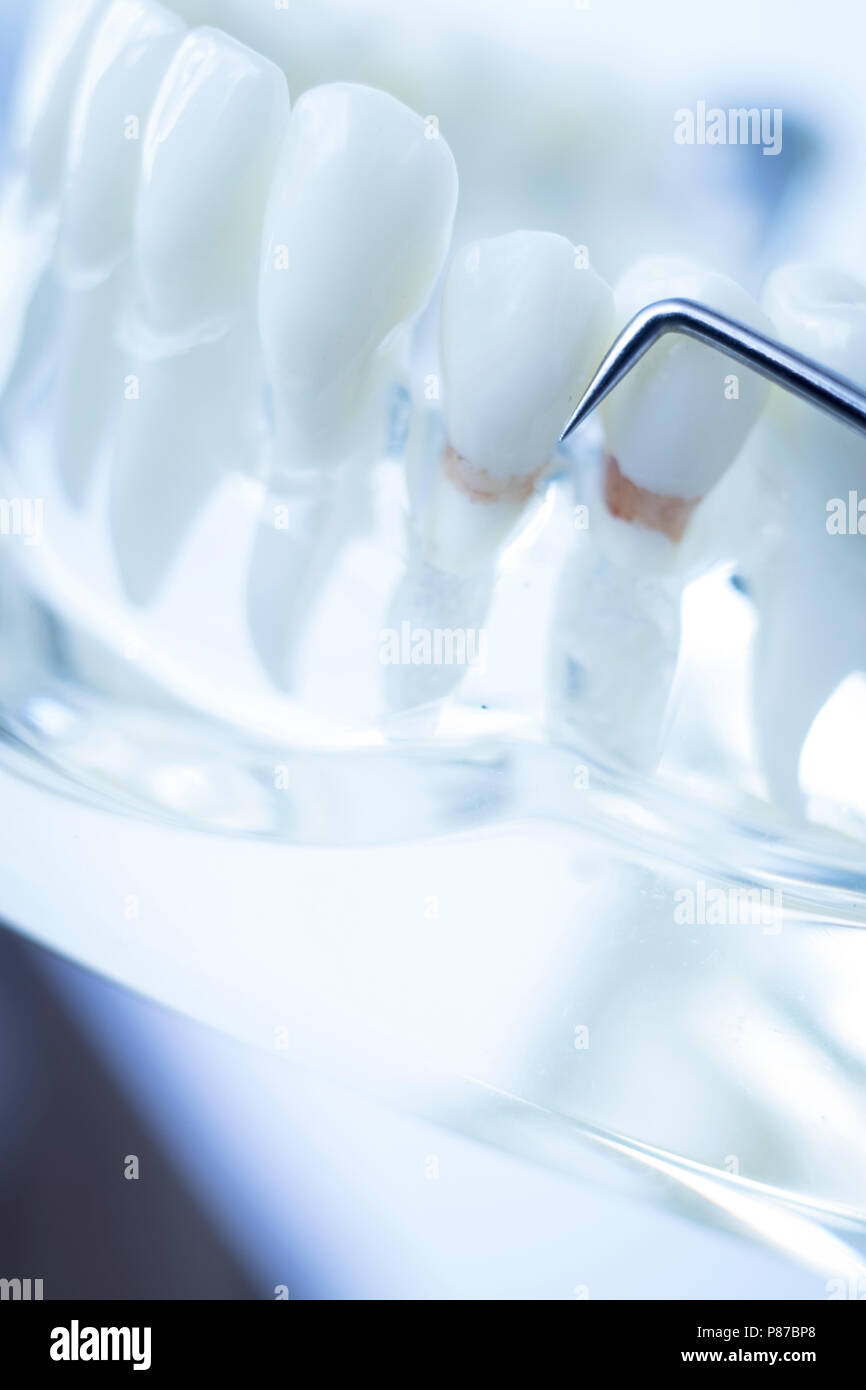 Dentist cleaning teeth with titanium metal tooth pick instrument to ...