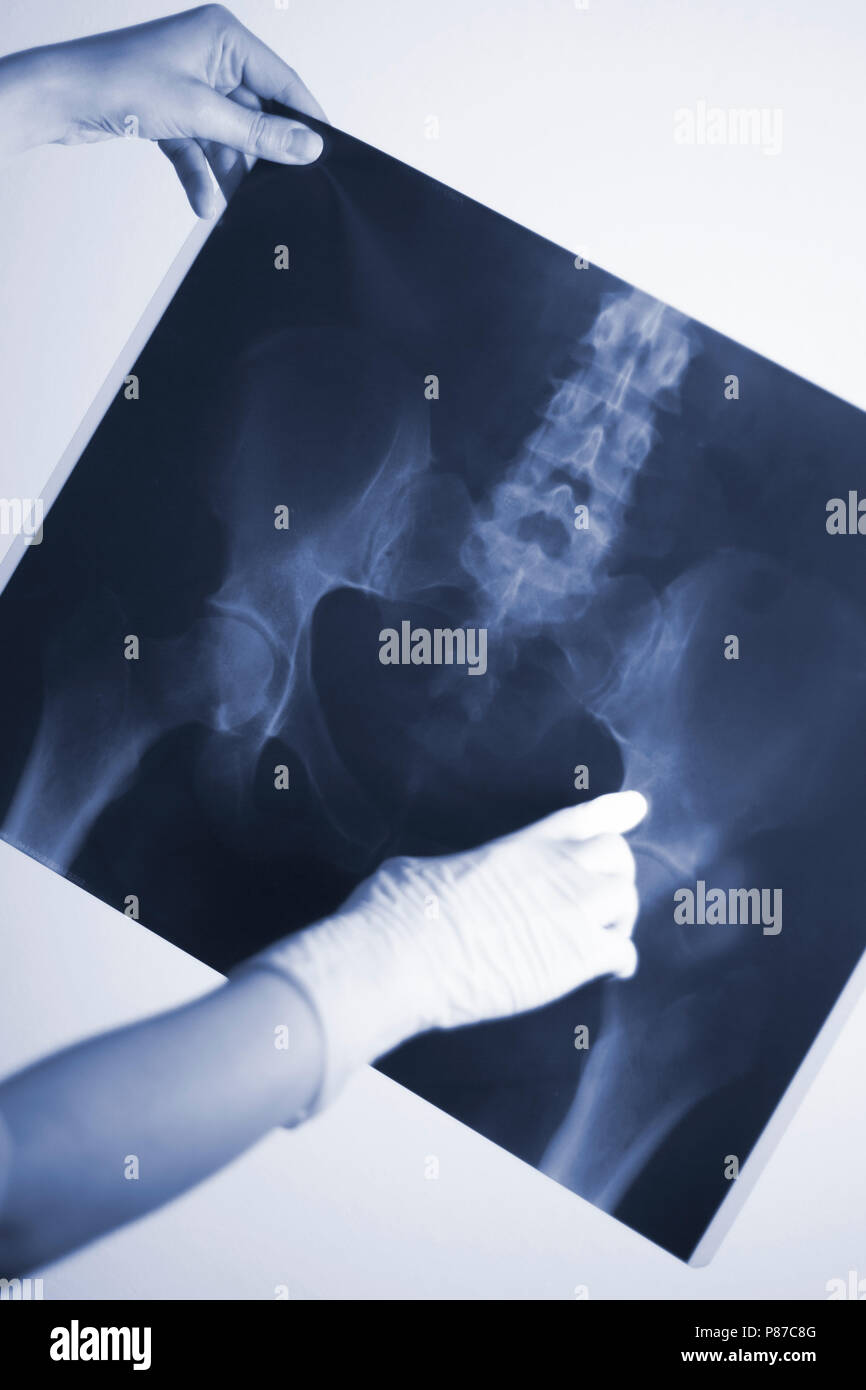 Medical hospital x-ray lowe back pain spine and hips traumatology scan ...