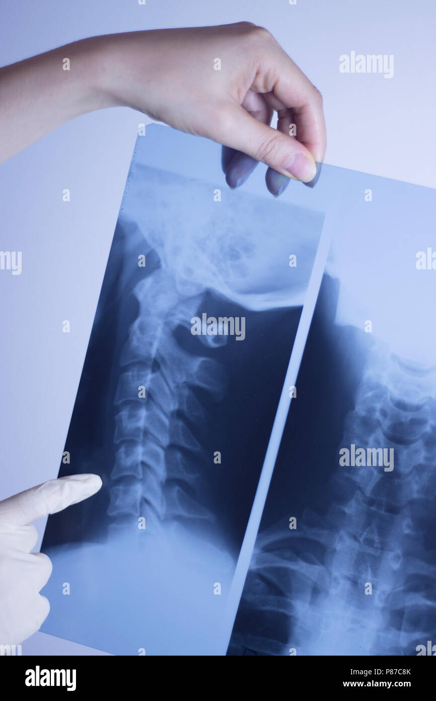 Medical hospital x-ray lowe back pain spine and neck traumatology scan ...