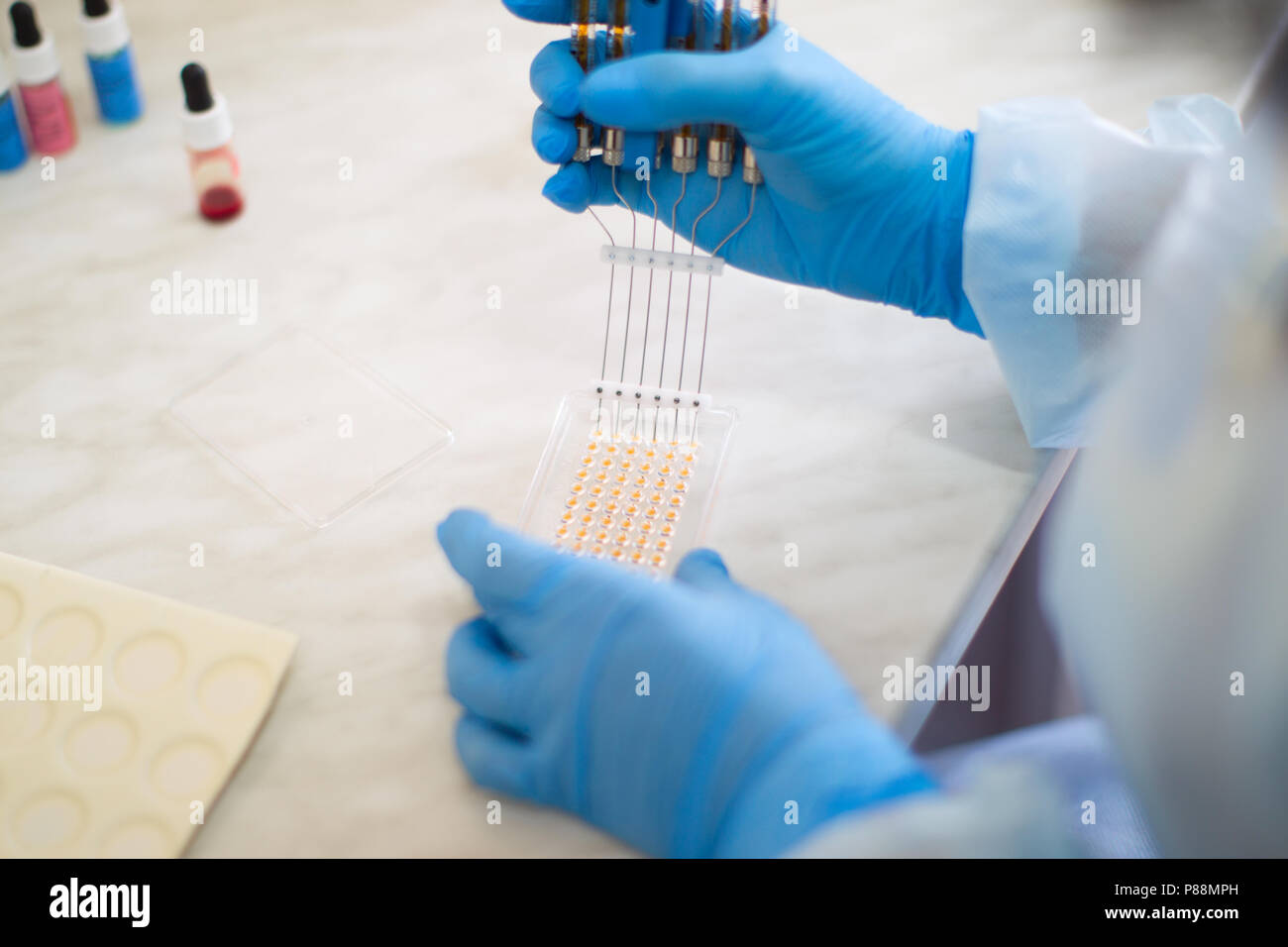 Examination of blood samples with a special syringe in the laboratory ...