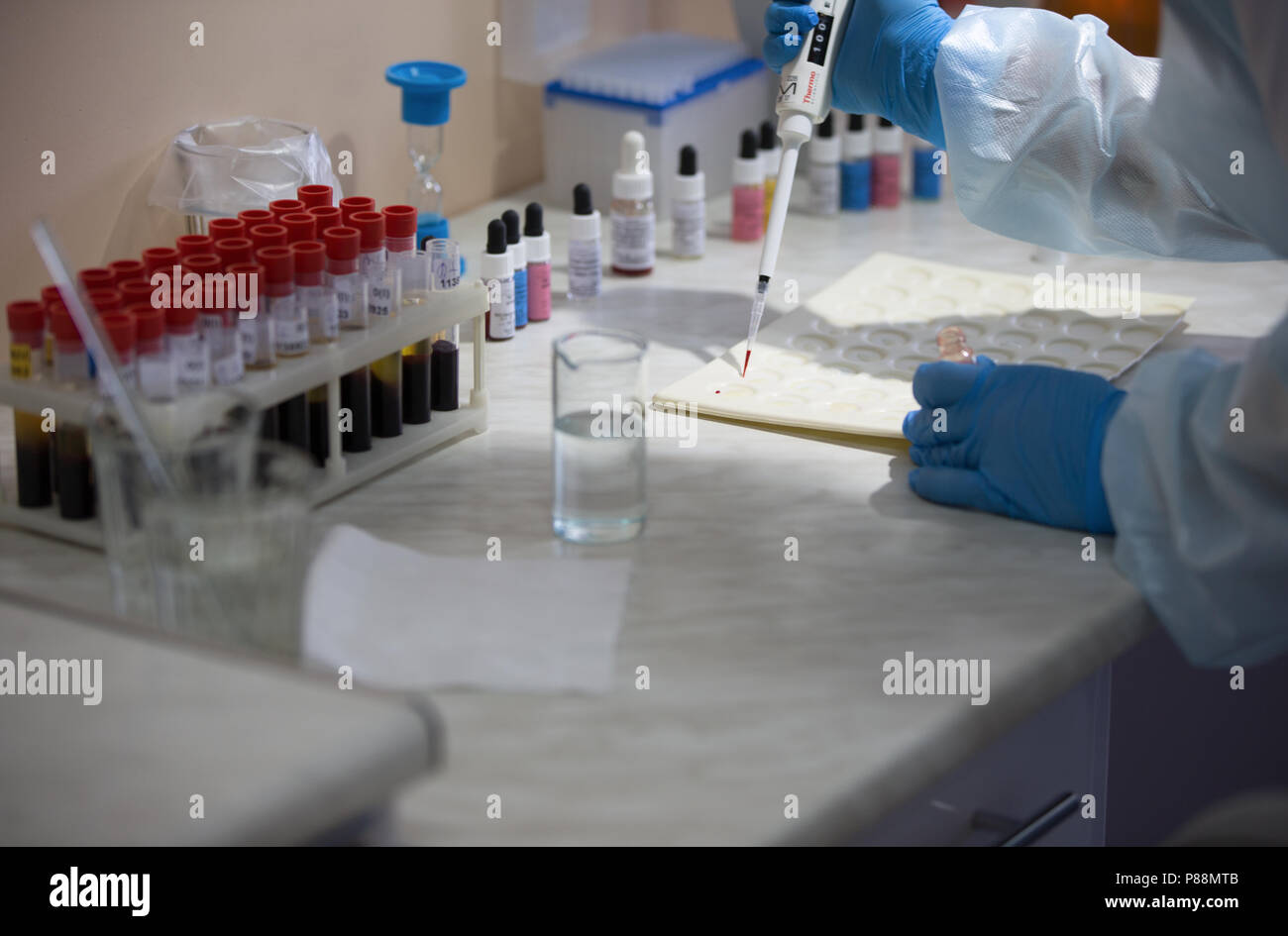 Belarus, Gomel, 24 April 2018. Blood transfusion station ...