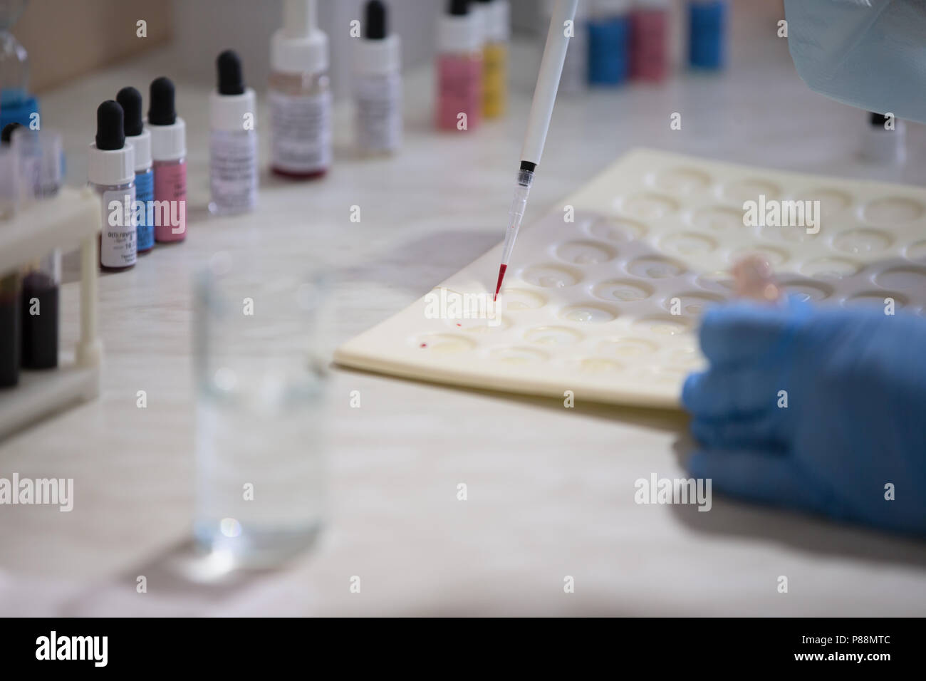 Microbiological examination of blood Stock Photo - Alamy