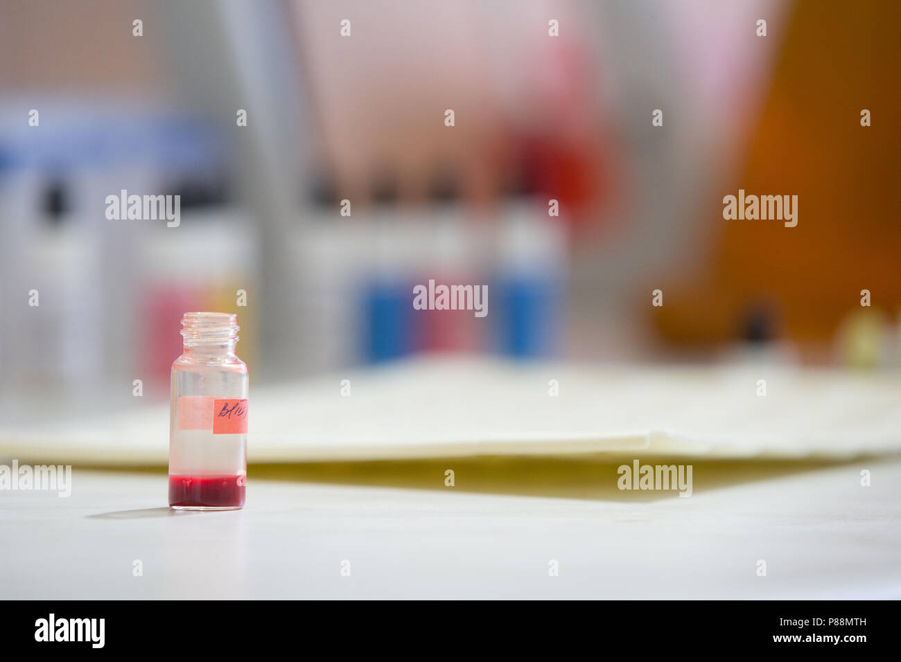 Blood test.Medical bottle with blood for examination with blood Stock ...