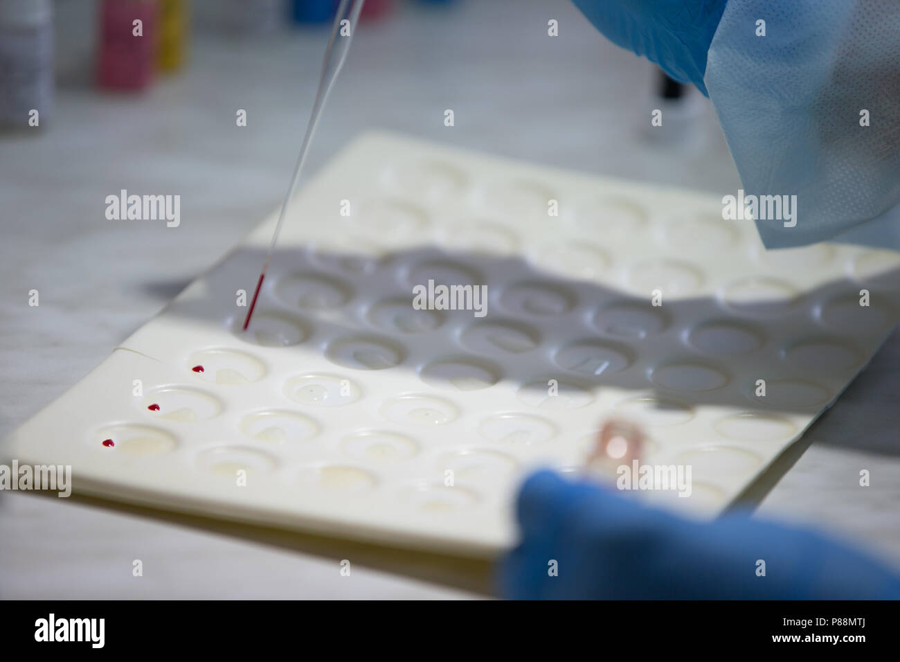 Blood test.Microbiological examination of blood Stock Photo - Alamy