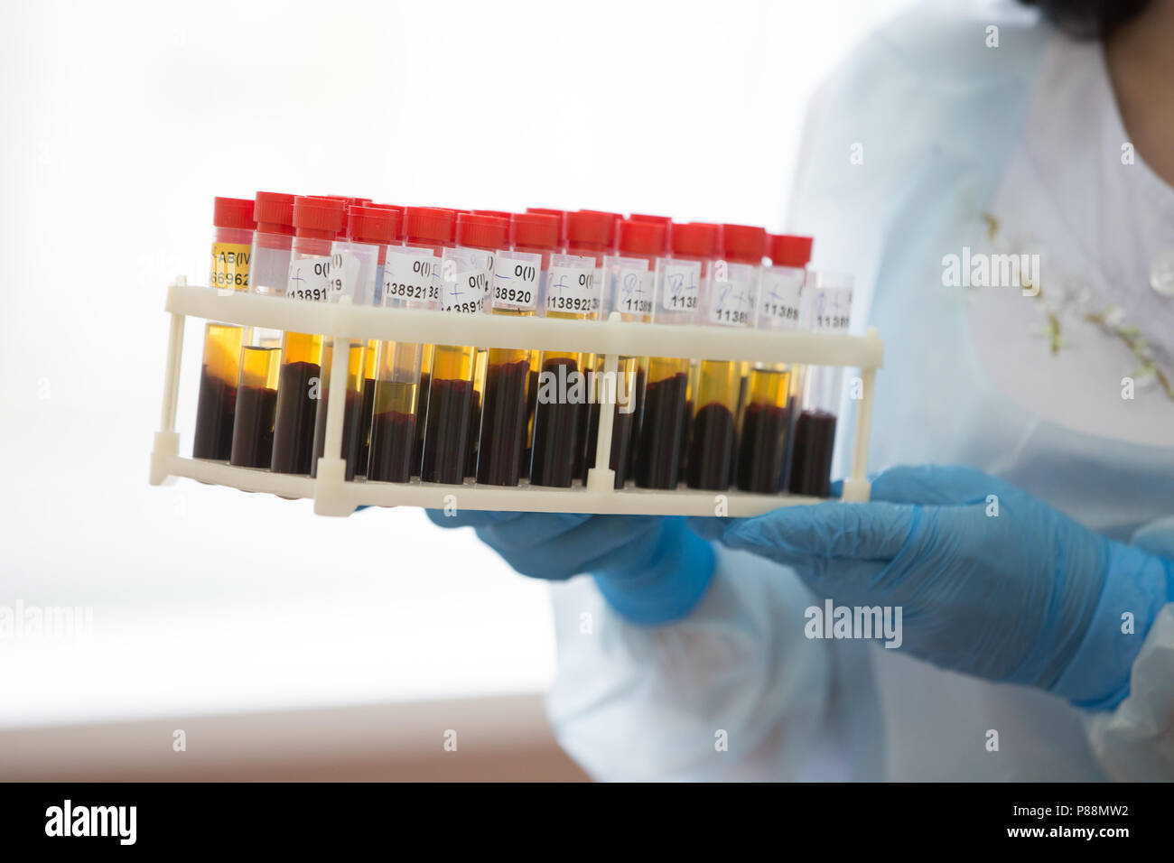 Blood drop in focus hi-res stock photography and images - Alamy