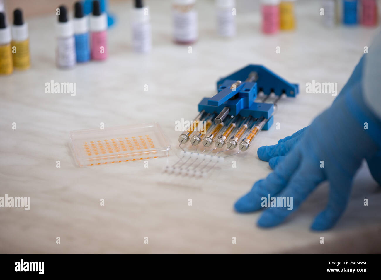 Blood group agglutination hi-res stock photography and images - Alamy