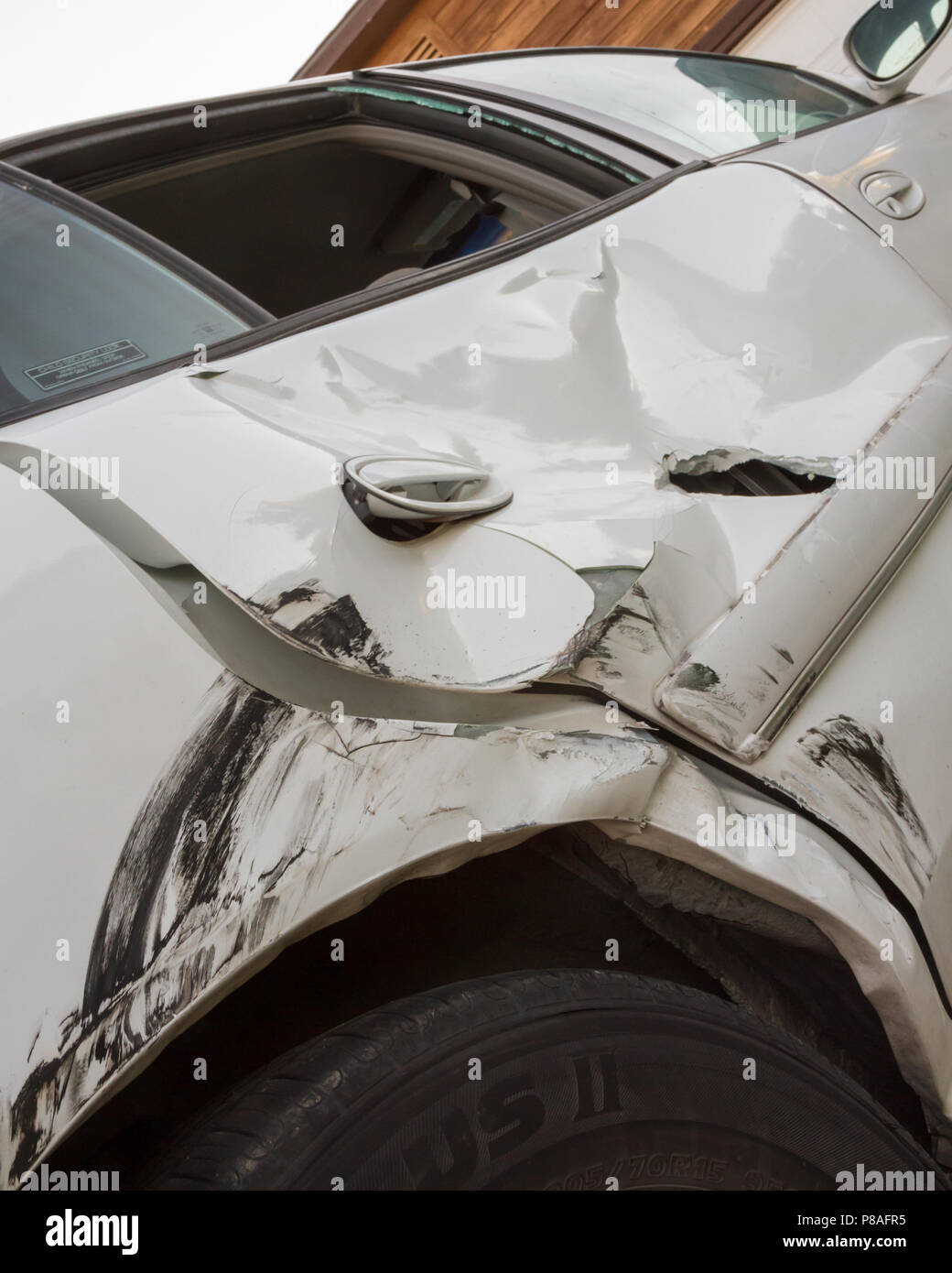 Crush injury hi-res stock photography and images - Alamy