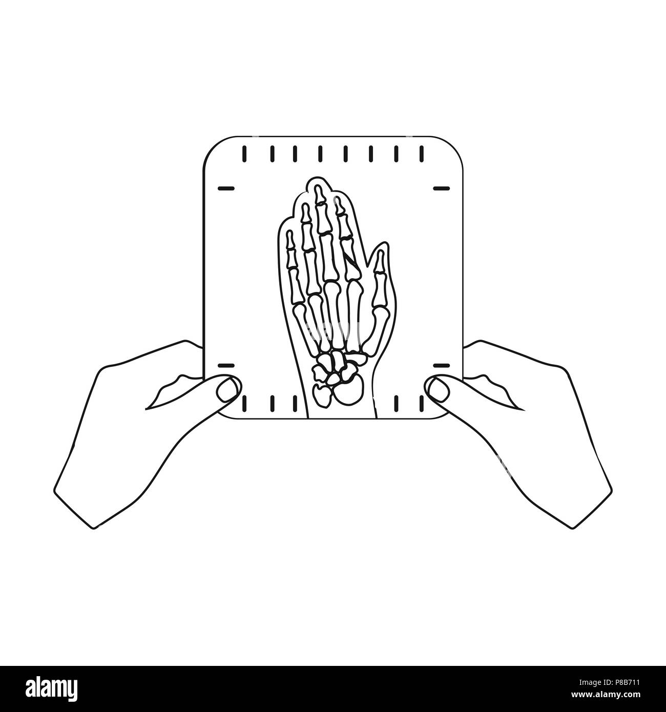 X-ray picture of the hand of a person in the hands of a radiologist ...
