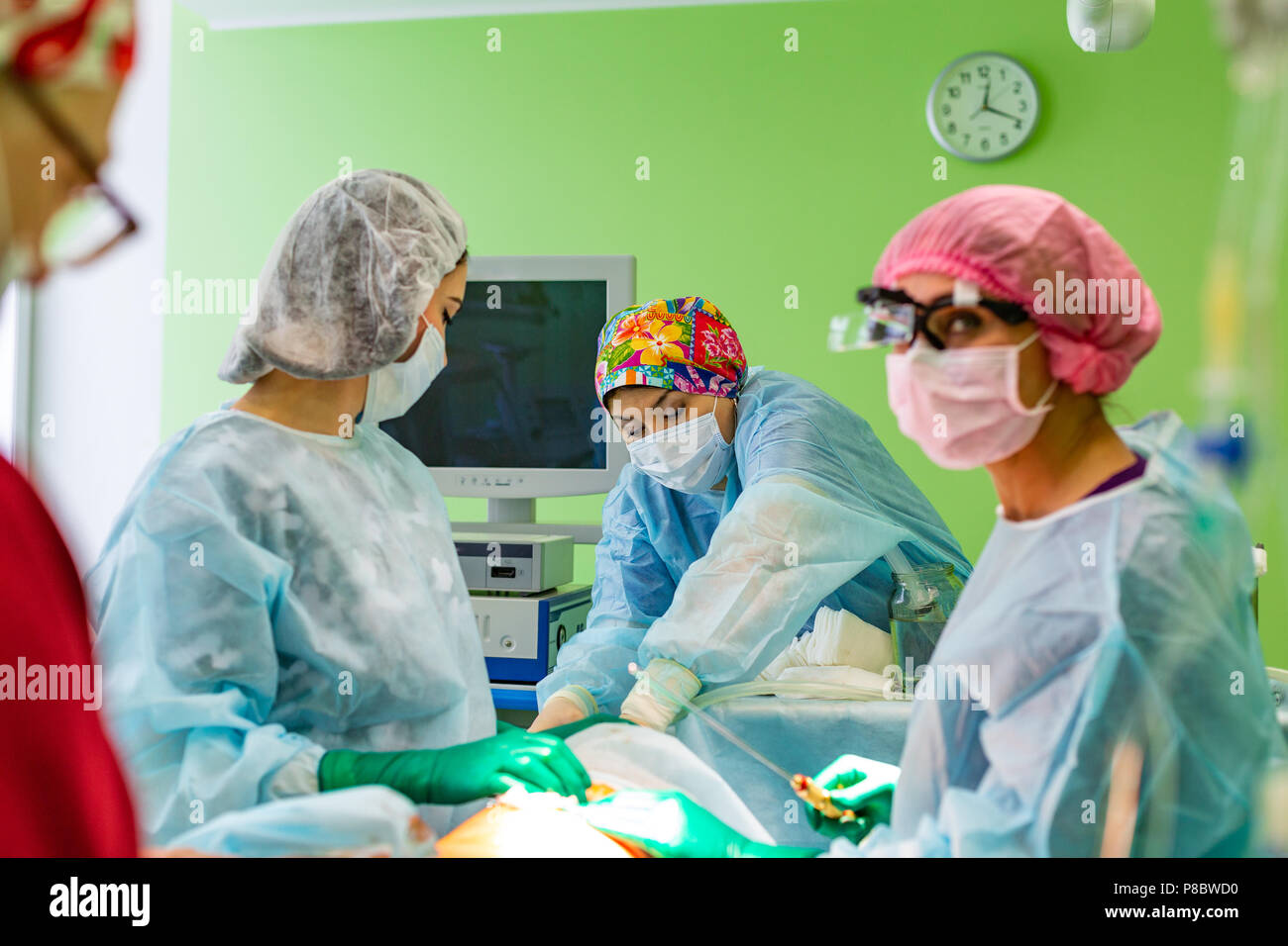 cosmetic liposuction surgery in actual operating room setting showing ...