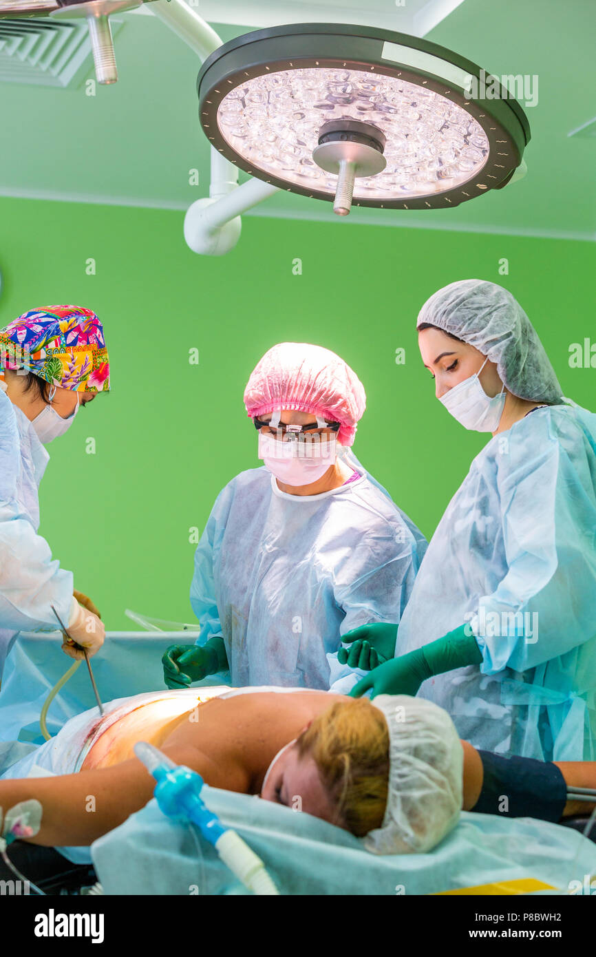 cosmetic liposuction surgery in actual operating room, group of ...