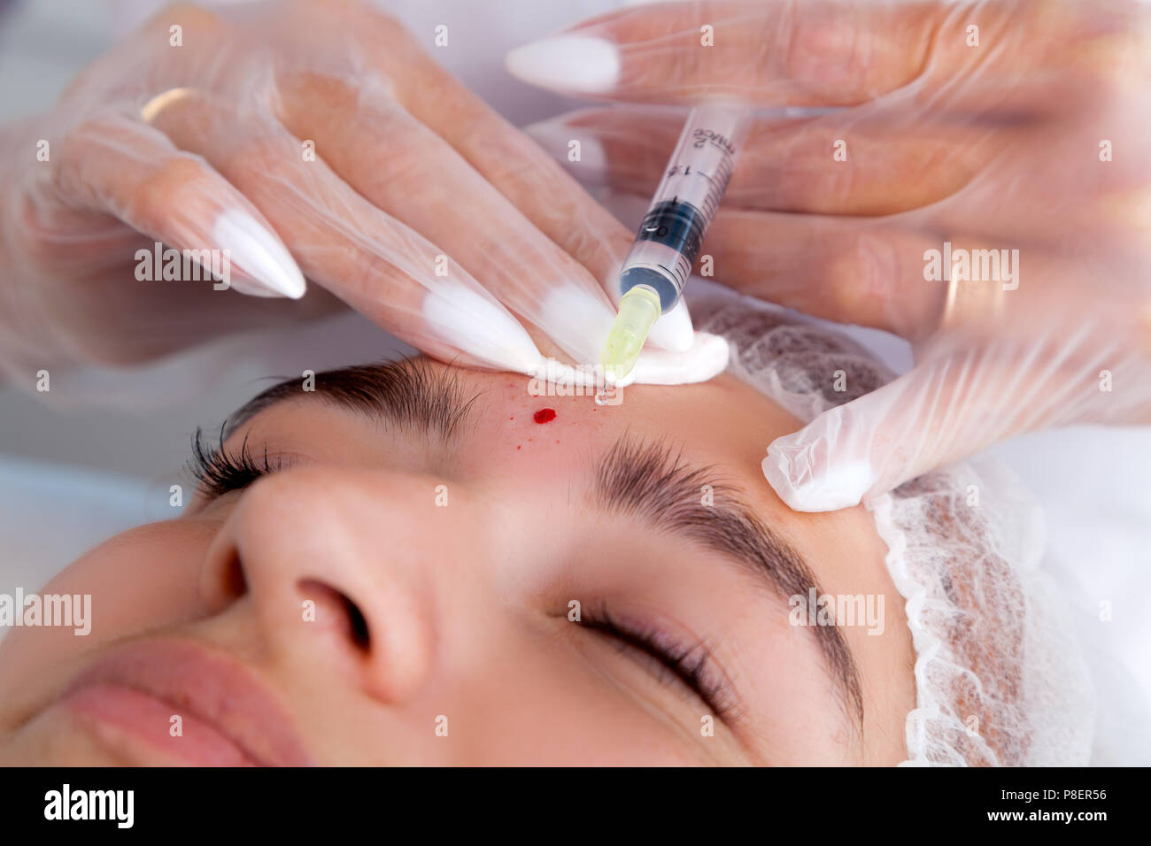 Regeneration smoothing hi-res stock photography and images - Alamy