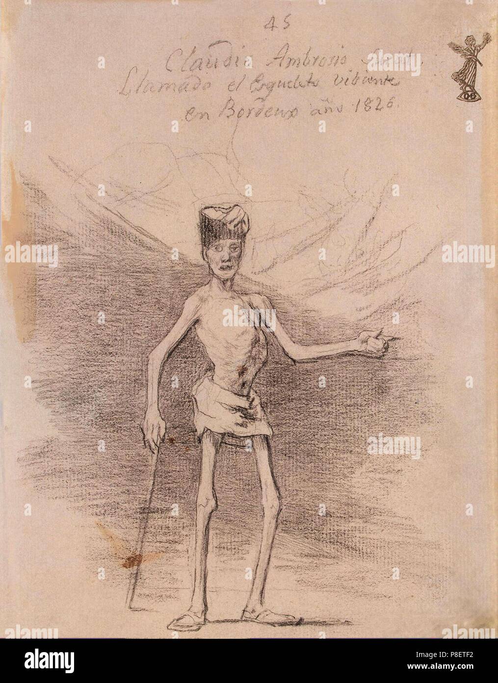 Claudio Ambrosio Surat, Known as the Living Skeleton. Museum: State ...