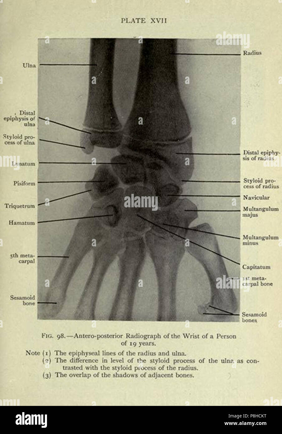vintage radio graphic x-ray plate annotated Stock Photo - Alamy