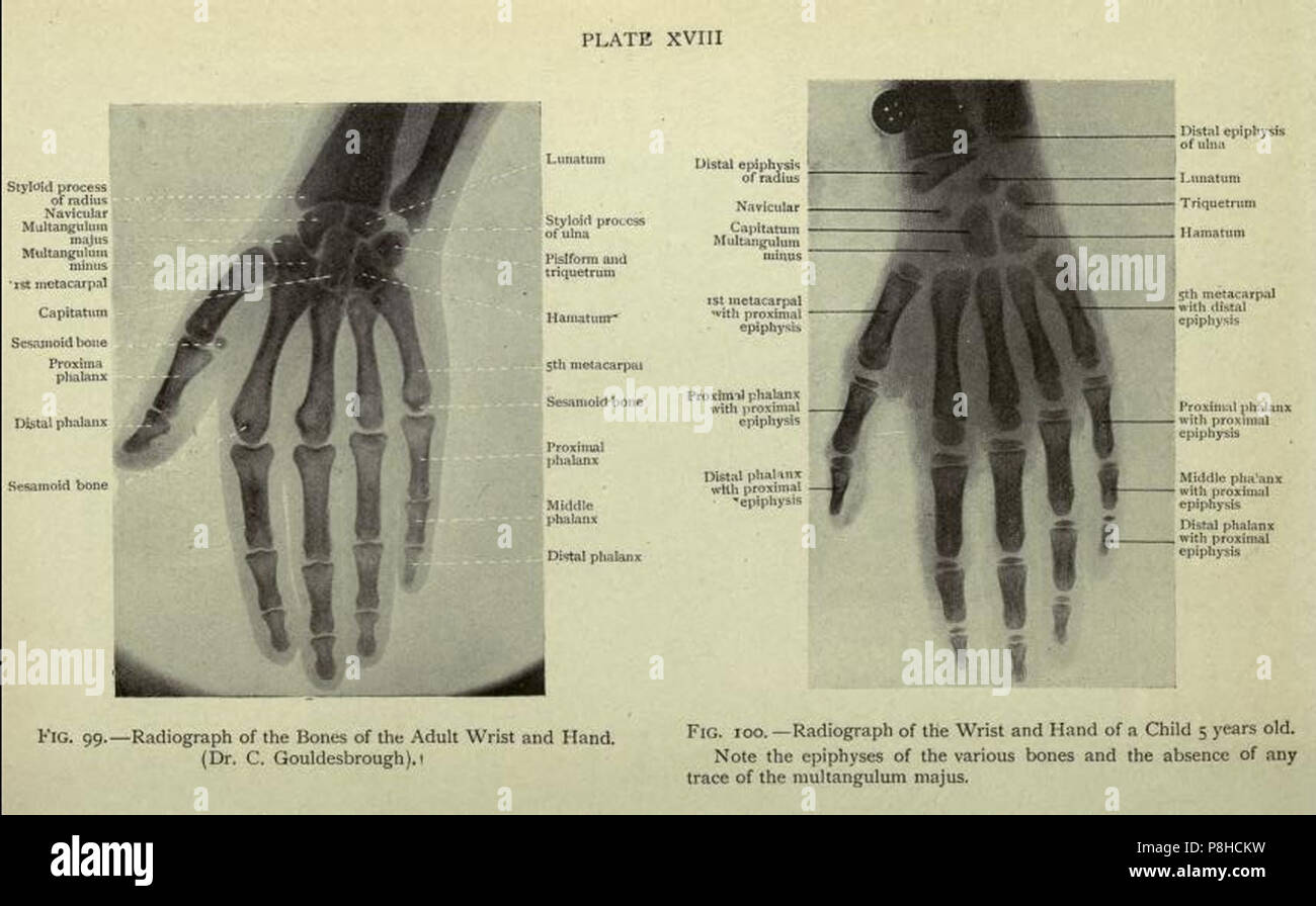 vintage radio graphic x-ray plate annotated Stock Photo - Alamy