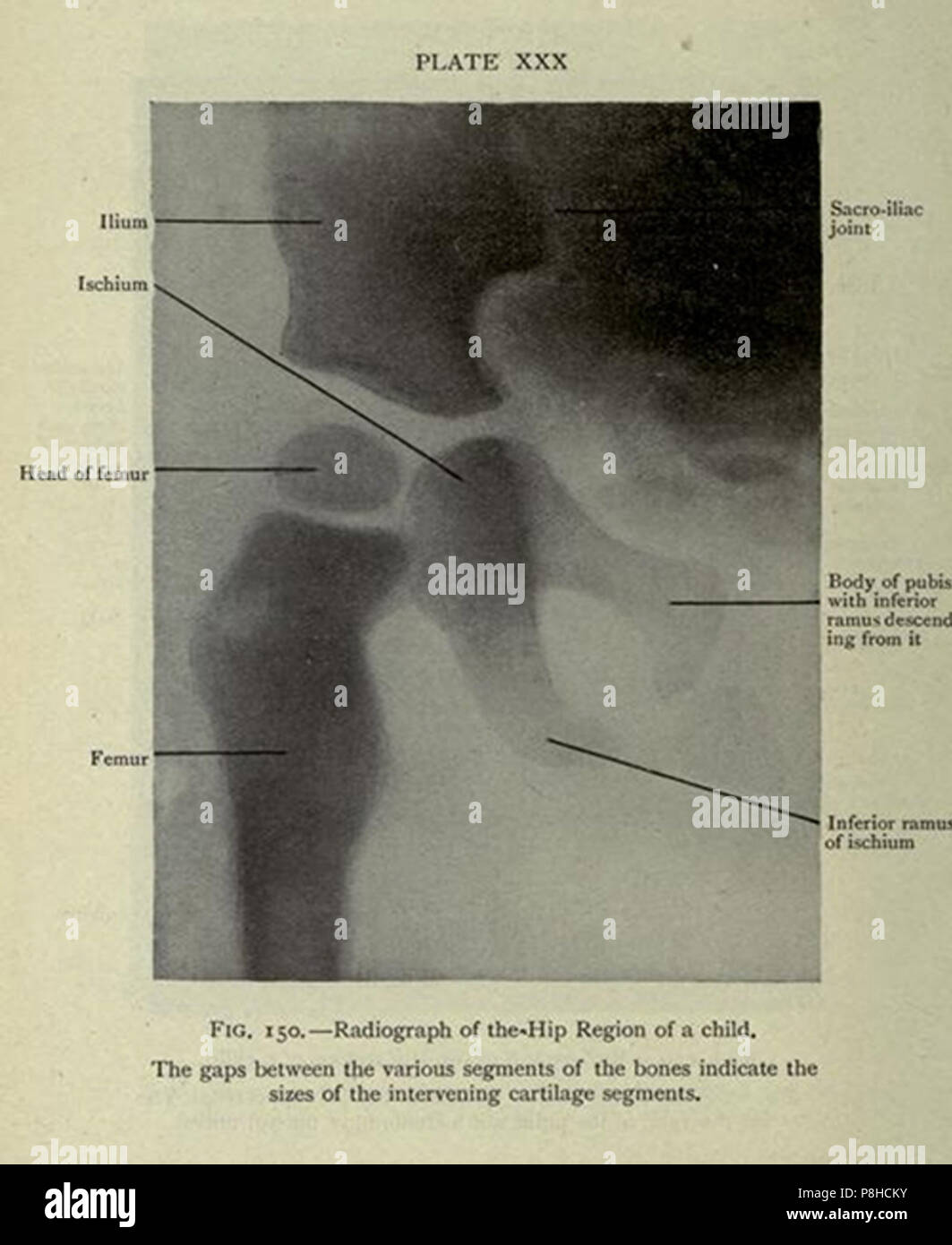 vintage radio graphic x-ray plate annotated Stock Photo - Alamy